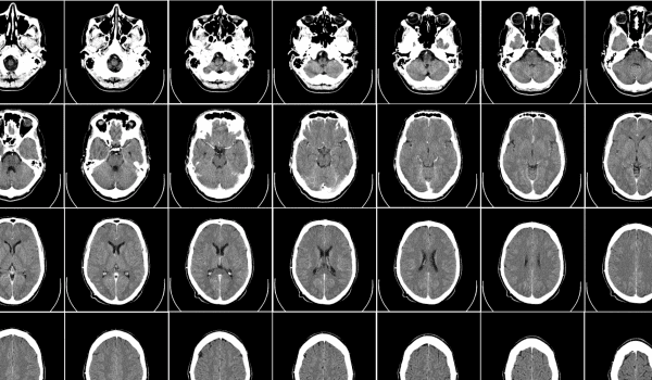 Microsoft GM of Worldwide Learning Says Neuroscience Is the Future in ...